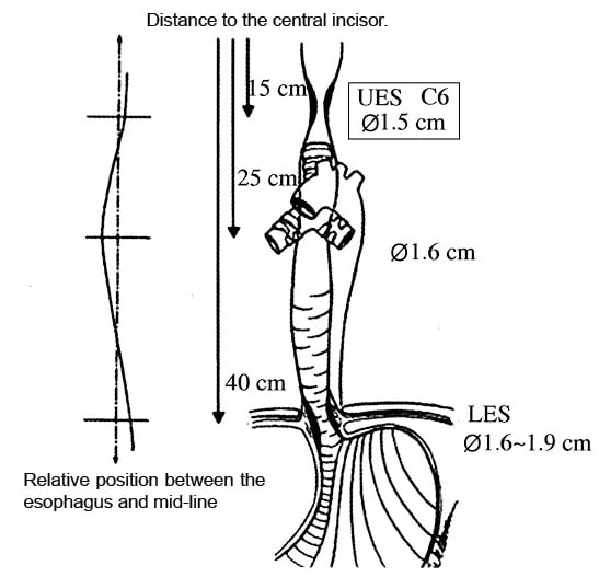 CITEC™ UES Esophageal Stent Supplier/Manufacturer/Company China | CITEC